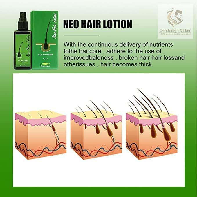 100% Original Made In Thailand Neo Hair Lotion with Derma Roller, Hair ...